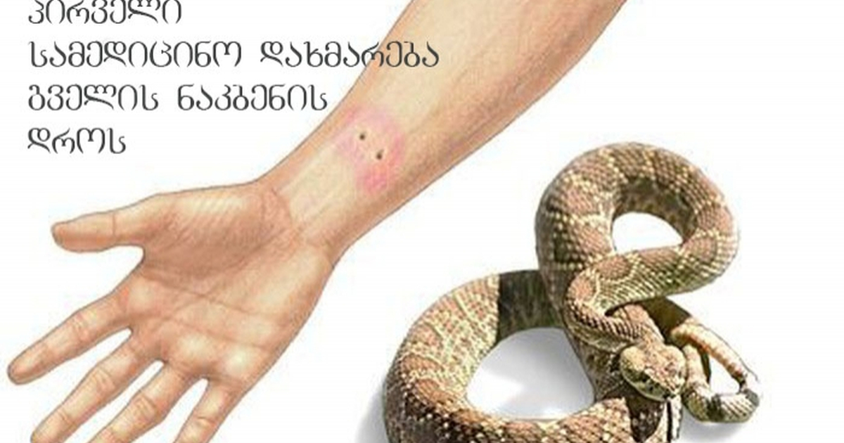რა გავაკეთოთ და რა არა გველის ნაკბენის დროს - პირველი სამედიცინო ...