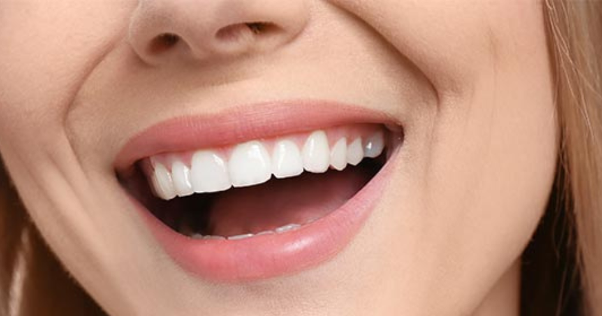 5 პროდუქტი რომლებიც ყველაზე მარტივად აფუჭებს კბილის ემალს ჩამონათვალი
